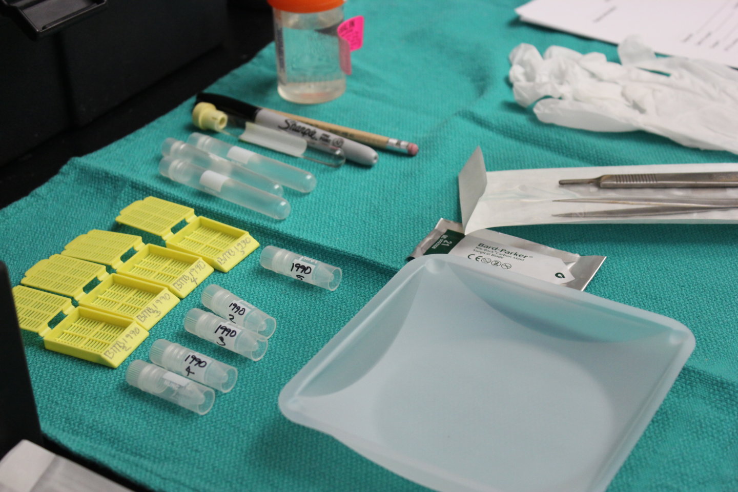 A lasting legacy: Brain Tumour Registry and Tissue Bank - Brain Tumour ...
